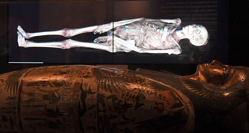 Secrets Of 2,300-Year-Old Golden Boy Mummy Revealed By CT scans ...